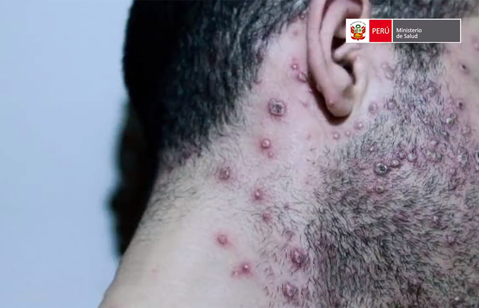 Las comunidades, en el centro de una respuesta urgente orquestada a la ...